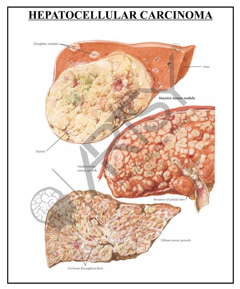 Pathology Charts