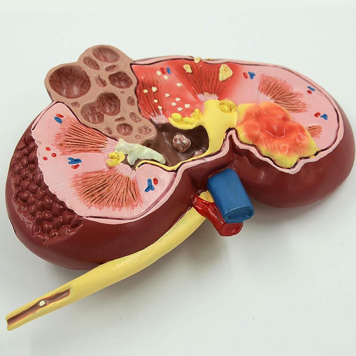 Human Kidney Model